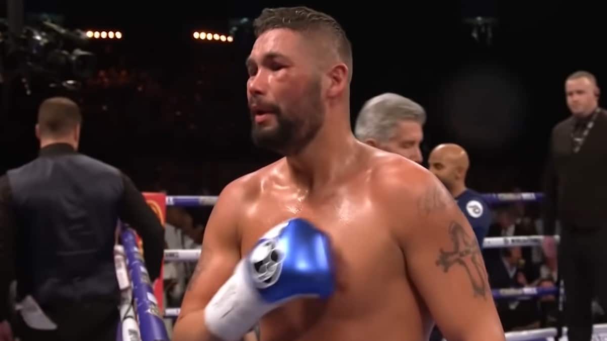 Tony Bellew