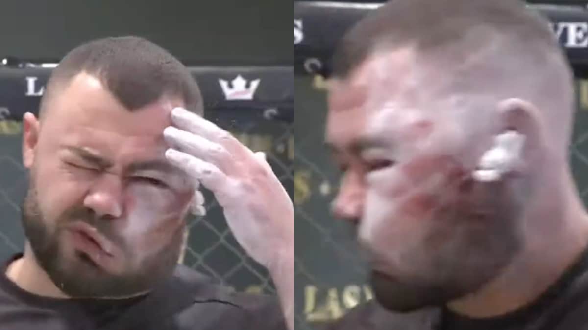 Sang et visage enflé, un concours de claques tourne mal