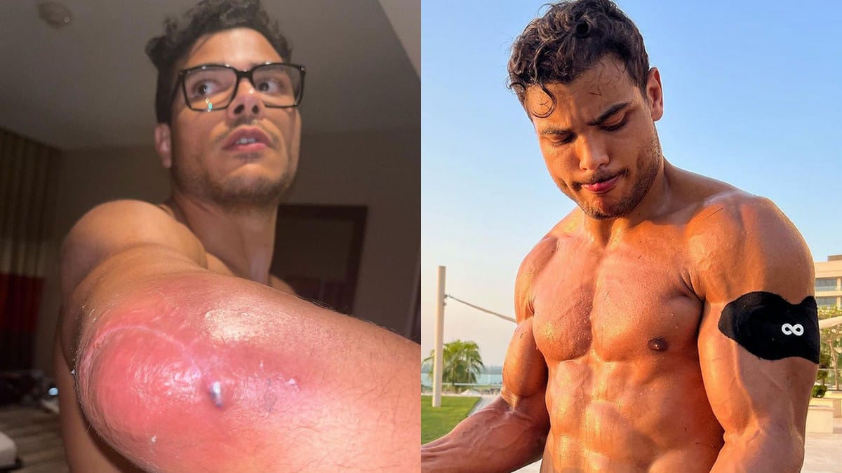 Paulo Costa blessé à 2 semaines de son retour contre Khamzat Chimaev