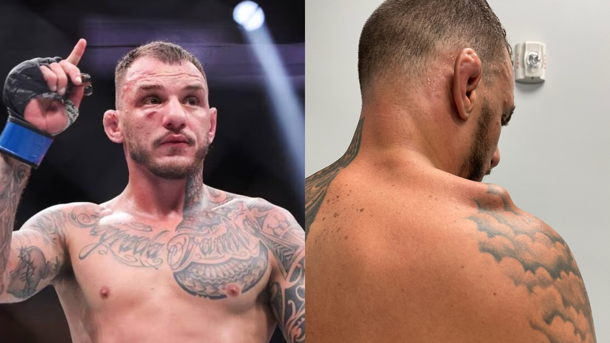 UFC Paris - Renato Moicano, lourdement blessé avant d'affronter BSD