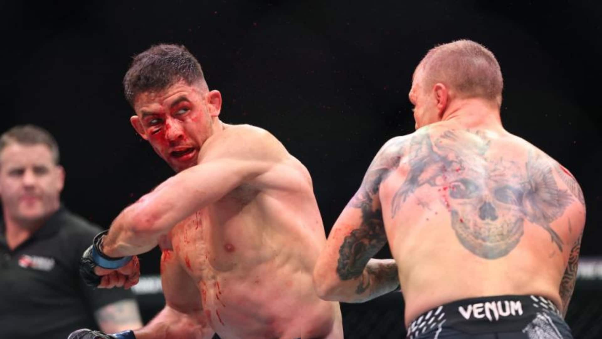 Bonus UFC Londres : Un bain de sang, des points de sutures et un ...